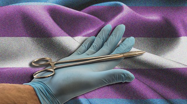 Transgender People Benefit From Gender-Affirming Surgery - The Rainbow ...